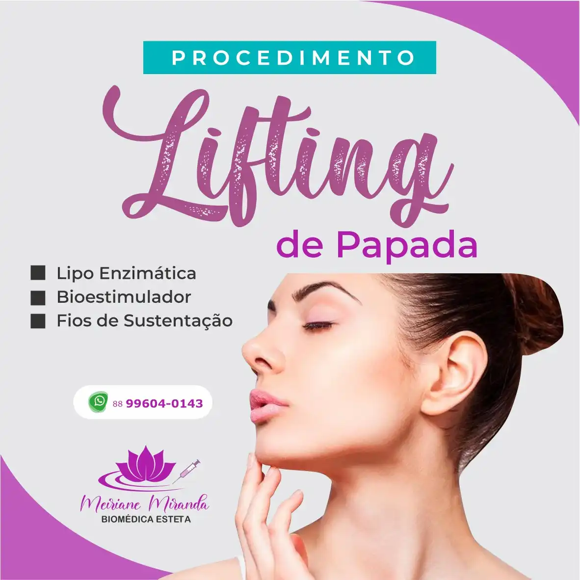 Propaganda Post Lifting de Papada Estética Facial – Agencia M9